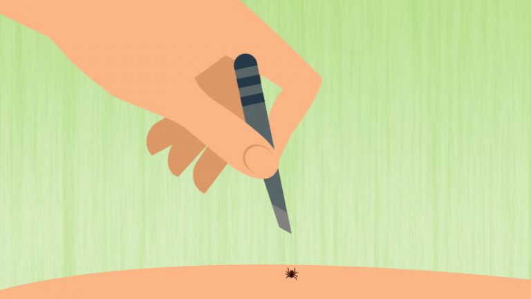 Tick Talk | How to Safely Remove a Tick
