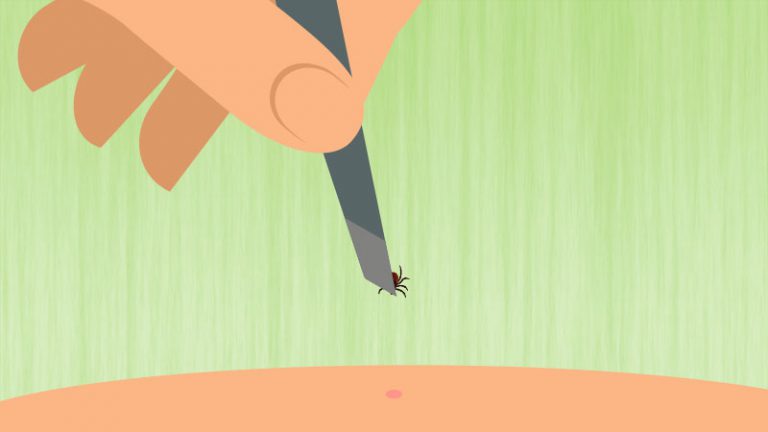 Tick Talk | How to Safely Remove a Tick